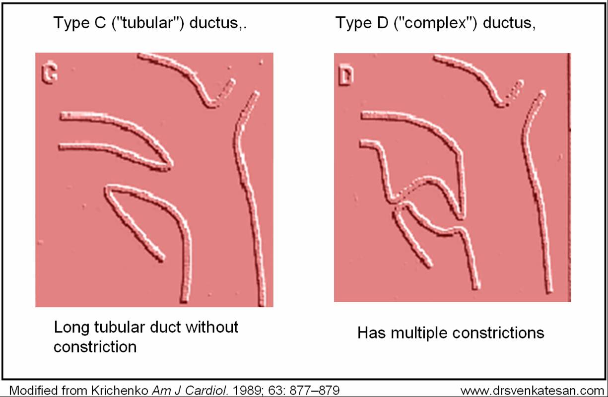 pda | Dr.S.Venkatesan MD