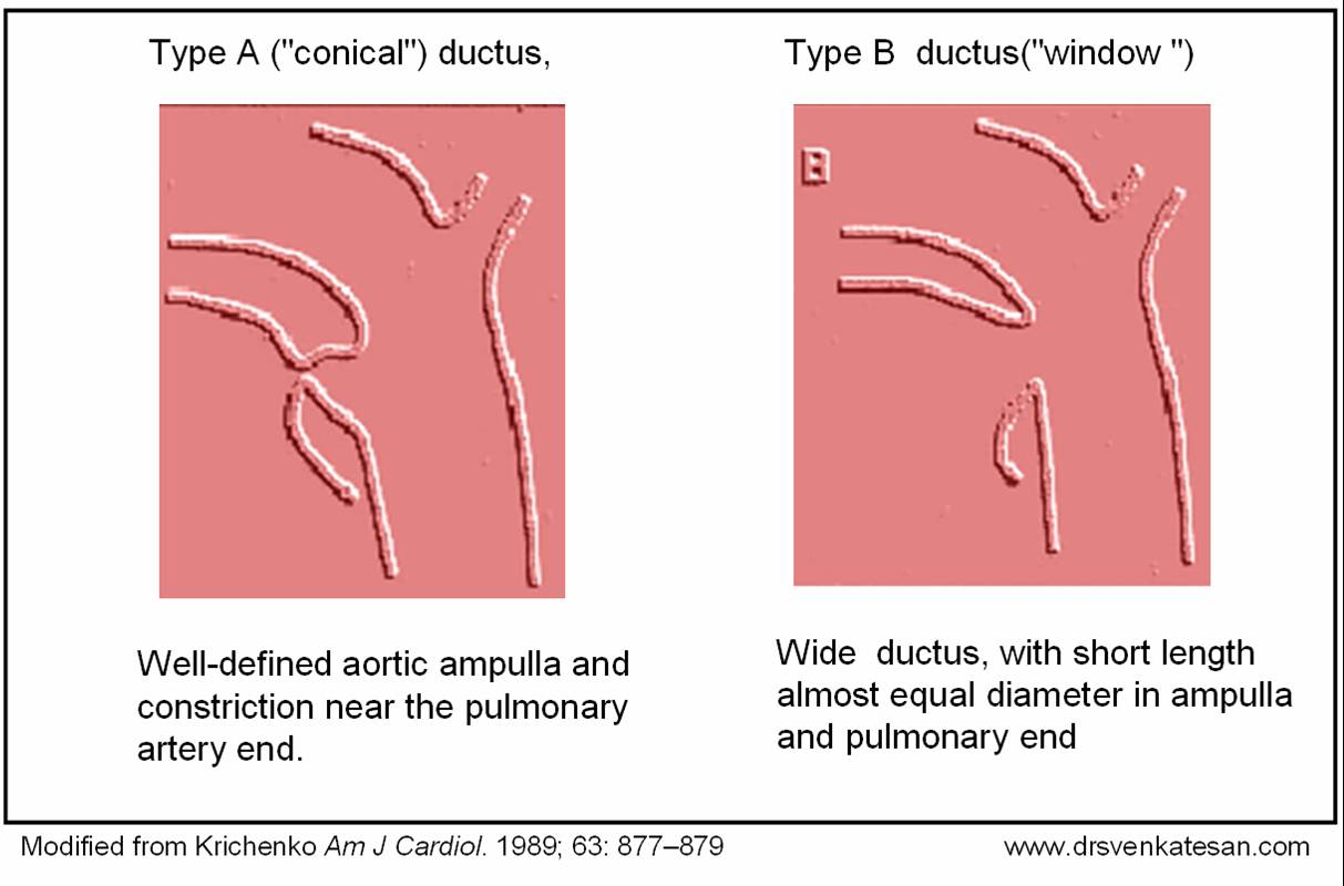 pda1 | Dr.S.Venkatesan MD