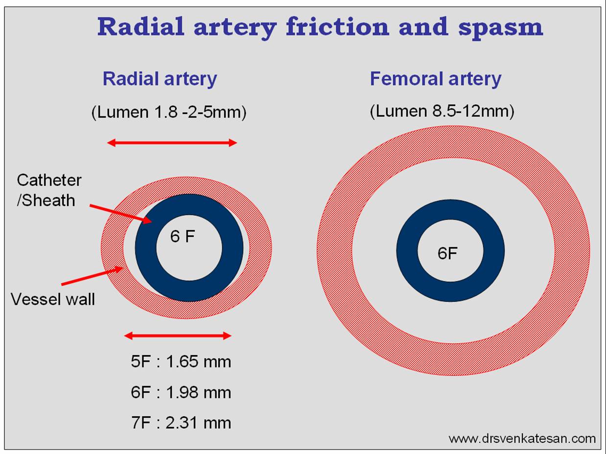 radial coronary angiogram | Dr.S.Venkatesan MD