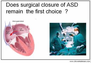 Management of Atrial septal defect : Device closure lagging behind ...
