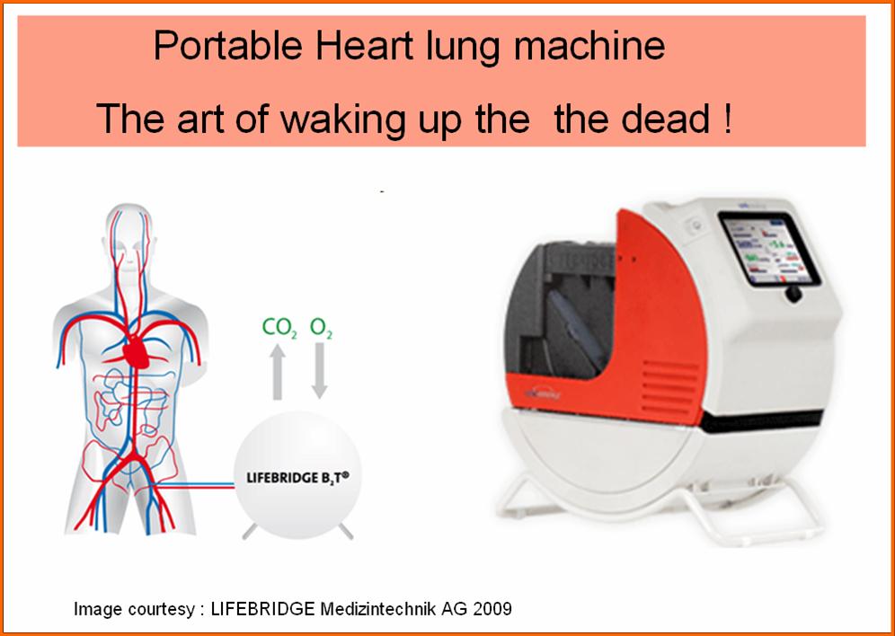 heart lung machine | Dr.S.Venkatesan MD