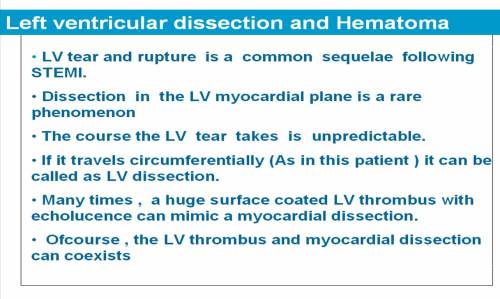 left ventricular dissection | Dr.S.Venkatesan MD