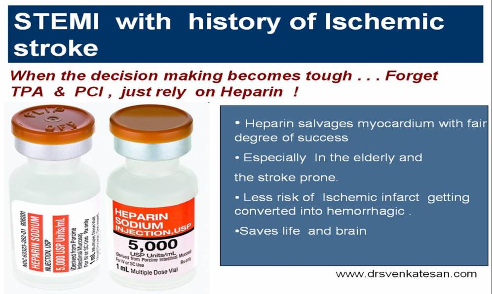 stroke in evolution | Dr.S.Venkatesan MD