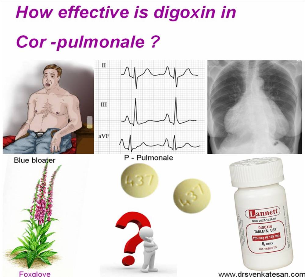 Does Digoxin know, which ventricle it is supposed to act in patients ...