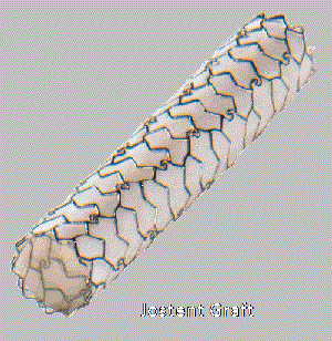 ptfe stent | Dr.S.Venkatesan MD