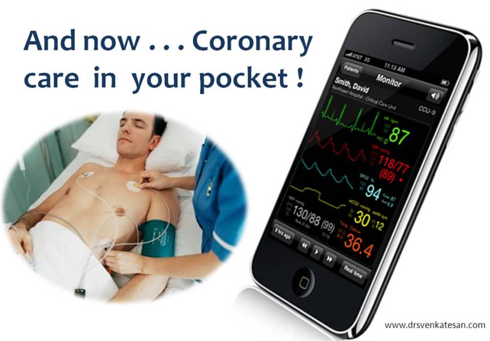 ecg in mobile phone | Dr.S.Venkatesan MD