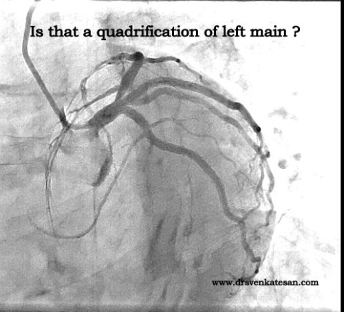 trifurcation and quadrification | Dr.S.Venkatesan MD