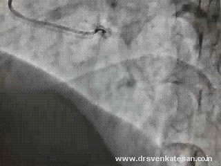 99% lad | Dr.S.Venkatesan MD