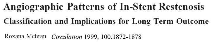 What is the best intervention for critical in-stent restenosis (ISR ...