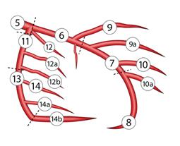 Proximal LAD means what ? | Dr.S.Venkatesan MD
