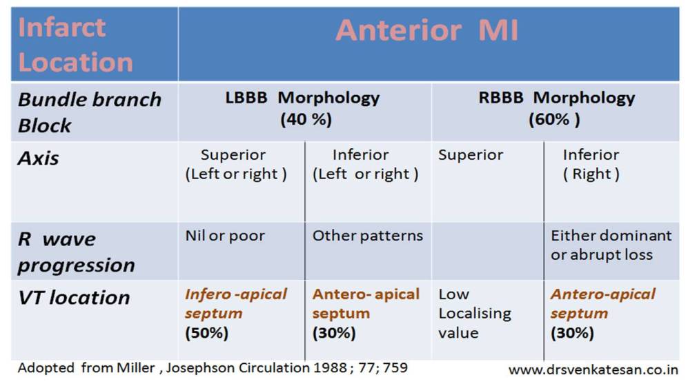Rbbb Morphology Vt Dr S Venkatesan Md