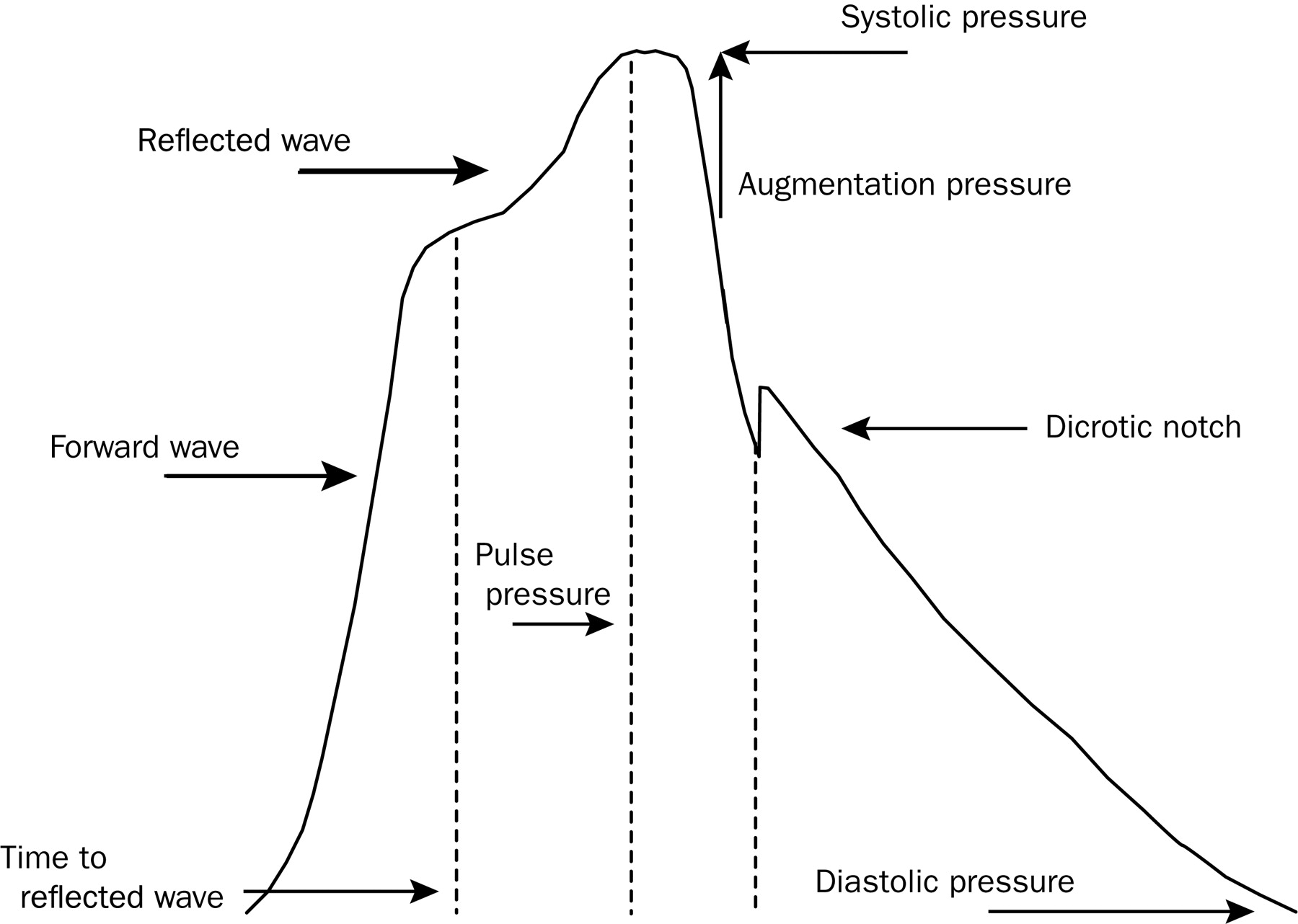 What is the mechanism of Isolated systolic hypertension (ISH) ? | Dr.S ...
