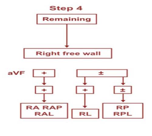 Arruda scheme for rapid localisation of WPW syndrome | Dr.S.Venkatesan MD