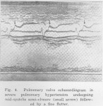 flying w sign | Dr.S.Venkatesan MD