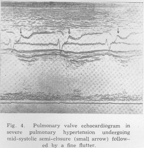 flying w sign | Dr.S.Venkatesan MD