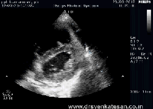 flying w sign | Dr.S.Venkatesan MD