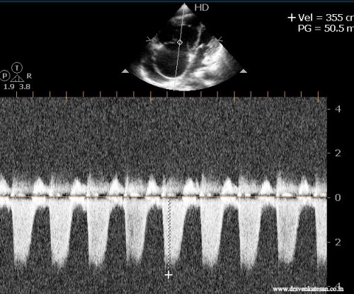 flying w sign | Dr.S.Venkatesan MD
