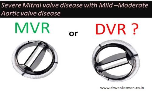 valvular heart disease | Dr.S.Venkatesan MD | Page 2