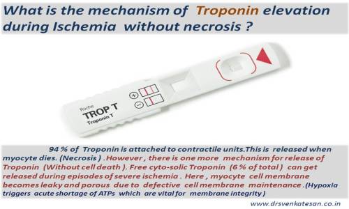 troponin i | Dr.S.Venkatesan MD