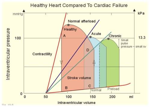 Dr.S.Venkatesan MD | Expressions in cardiology