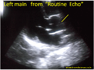 cardiology-Anatomy | Dr.S.Venkatesan MD
