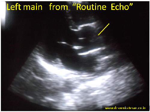 cardiology-Anatomy | Dr.S.Venkatesan MD