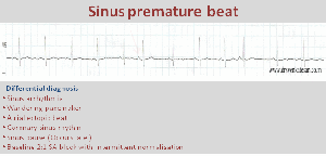 sinus node anatomy | Dr.S.Venkatesan MD