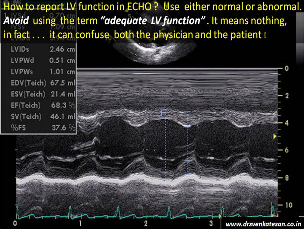 echocardiography | Dr.S.Venkatesan MD