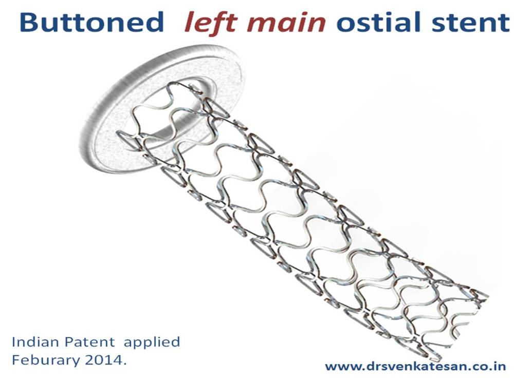 A new stent design for Left main ostial lesion ! | Dr.S.Venkatesan MD