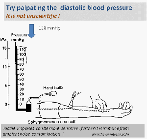 Can we measure diastolic blood pressure by palpation ? | Dr.S.Venkatesan MD