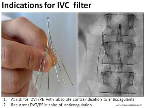 Cardiology -Hemodynamics | Dr.S.Venkatesan MD