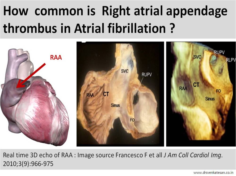 cardiology-Anatomy | Dr.S.Venkatesan MD