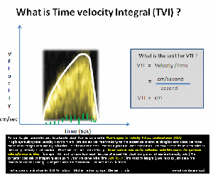 What is time velocity Integral ? (VTI ) | Dr.S.Venkatesan MD