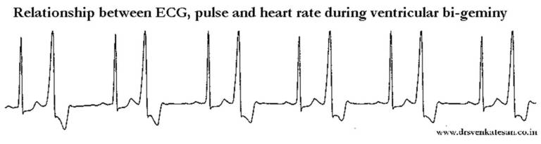 Auscultation | Dr.S.Venkatesan MD