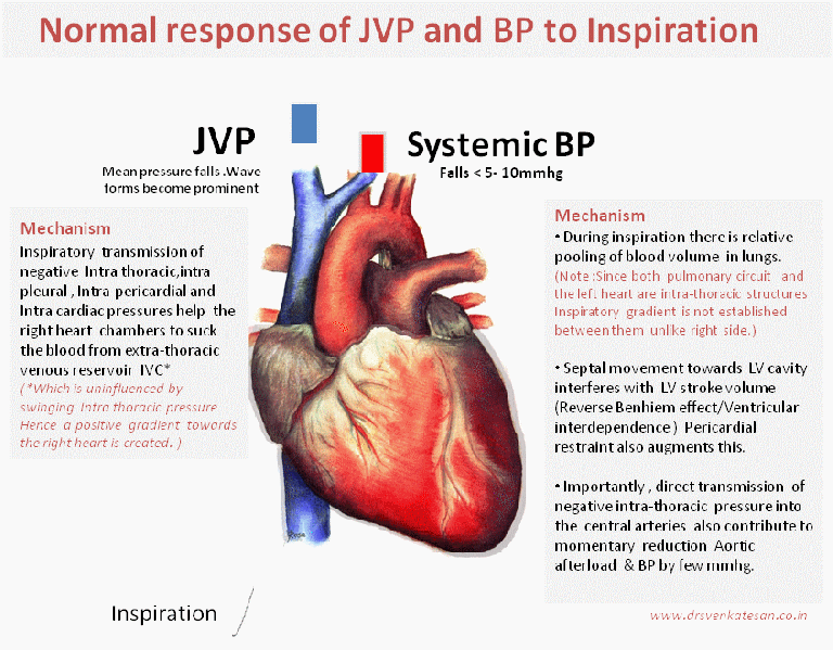 What is the effect of Inspiration on JVP and blood pressure ? | Dr.S ...