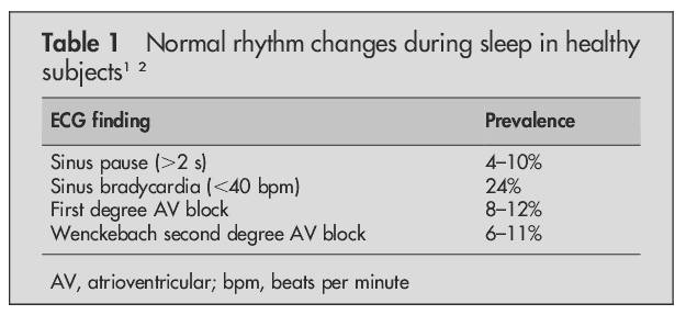 Nocturnal pauses in Holter monitoring : How significant is it ? | Dr.S ...