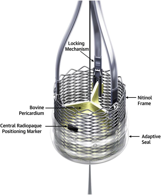Heart valves | Dr.S.Venkatesan MD