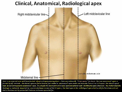 Three types of cardiac apical Impulse : An Illustration | Dr.S ...