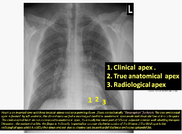 Dr.S.Venkatesan MD | Expressions in cardiology | Page 41