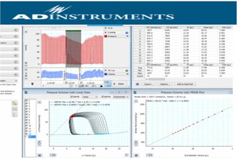 Ventricular pressure volume loop : An animated fusion Image | Dr.S ...