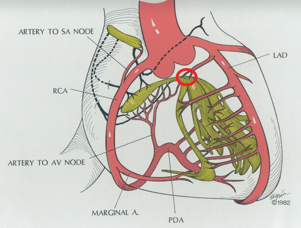 Blood supply of cardiac conduction system | Dr.S.Venkatesan MD