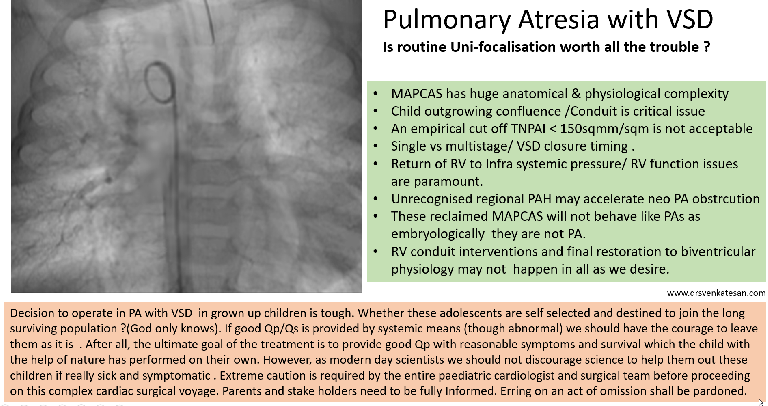 pulmonary atresia with vsd | Dr.S.Venkatesan MD