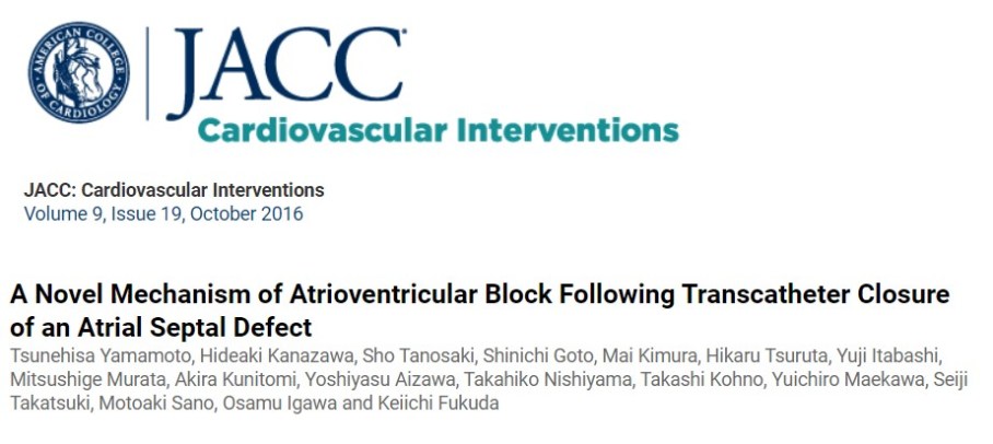ASD device closure | Dr.S.Venkatesan MD