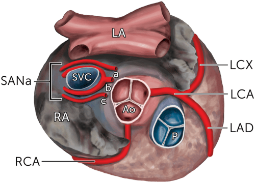 ASD device closure: “Mind the gap” to avoid SA nodal artery compression ...