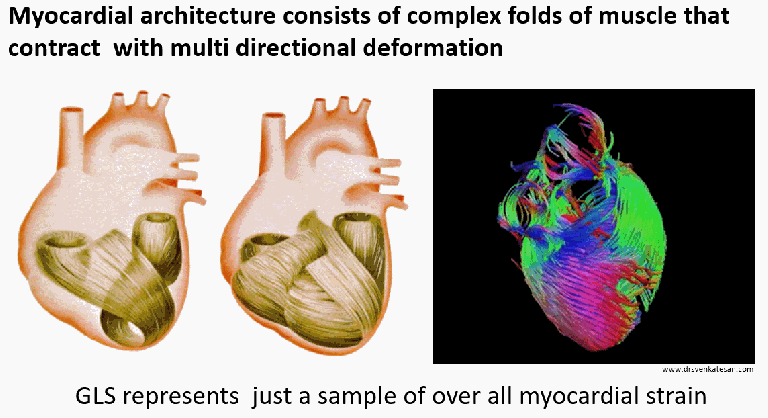 Department of error: GLS doesn’t really reflect the global LV function ...