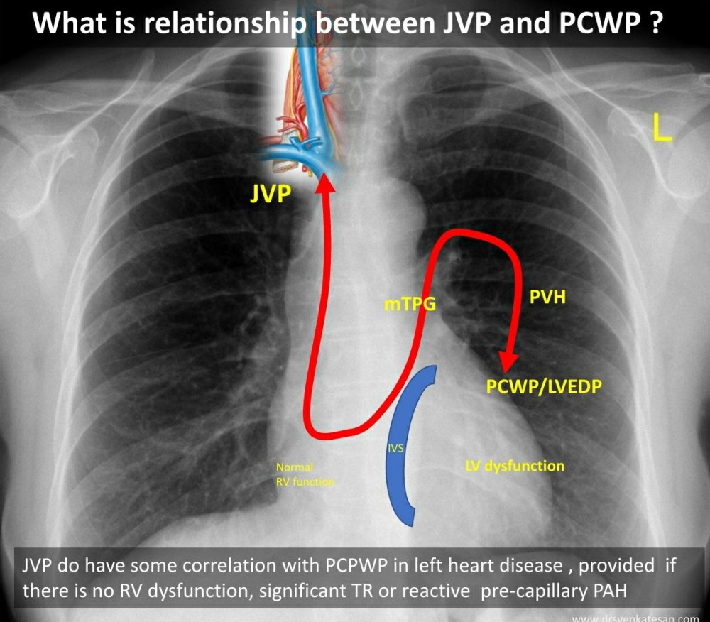 JVP -Jugualr venous pulse | Dr.S.Venkatesan MD