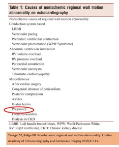 Department of artifact : Normal “wall motion defect” in ...