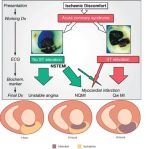 New ESC 2023, ACS guidelines : “STEMI merges with NSTEMI” for some good ...