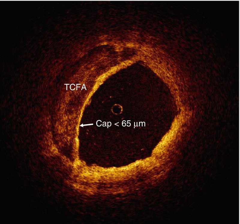 Dr.S.Venkatesan MD | Expressions in cardiology | Page 9