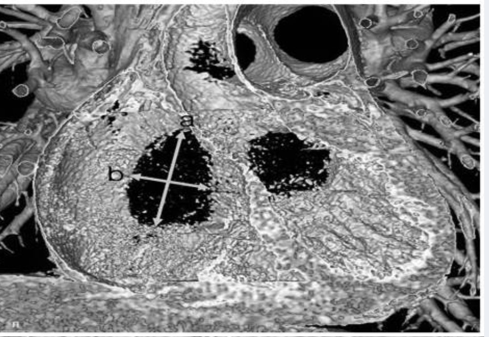 Dr.S.Venkatesan MD | Expressions in cardiology | Page 5